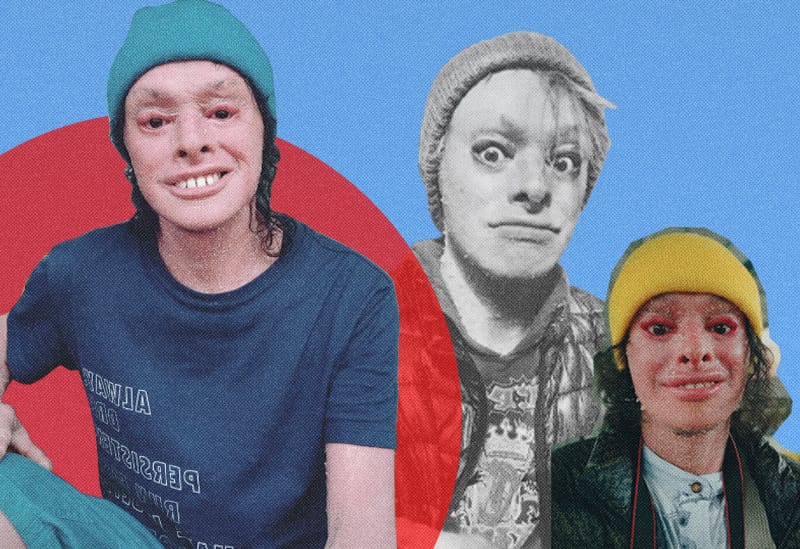 Tío Panshís, el tiktoker que enseña a aceptar la diversidad con su piel ...